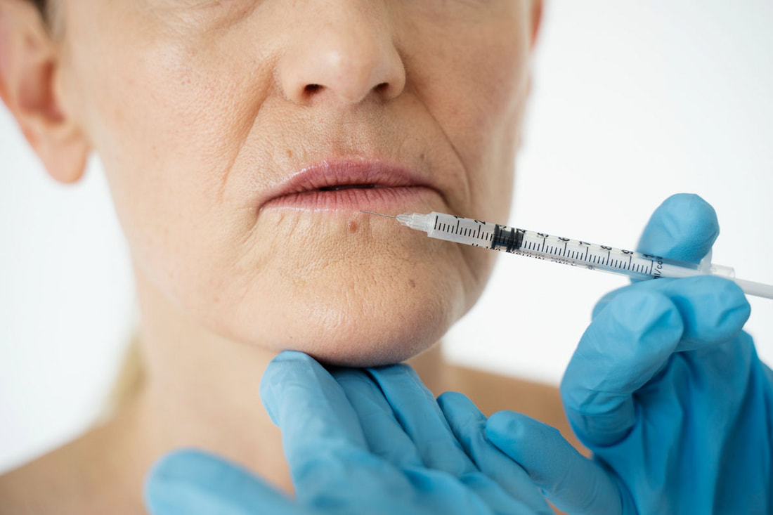 Anti-Wrinkle Injections | Botox, Fillers & Skin Booster | Face Doctors